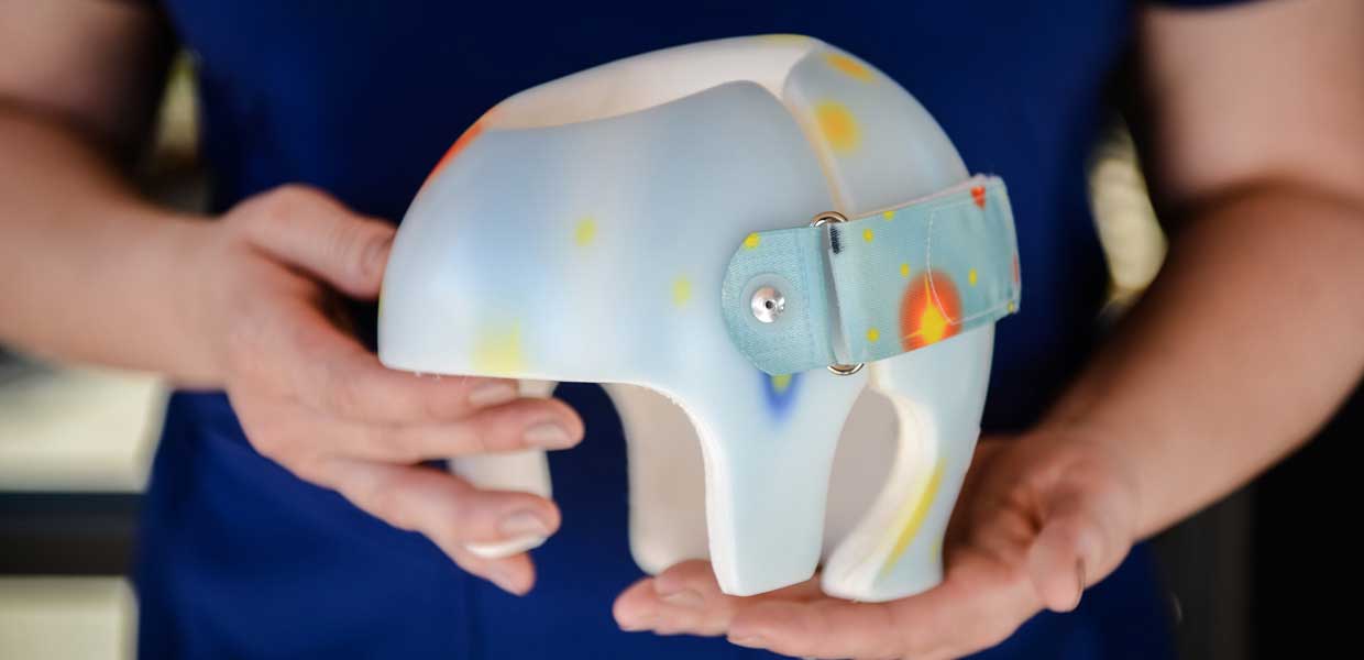Children's Orthotics and Prosthetics – Cranial Remolding Specialists